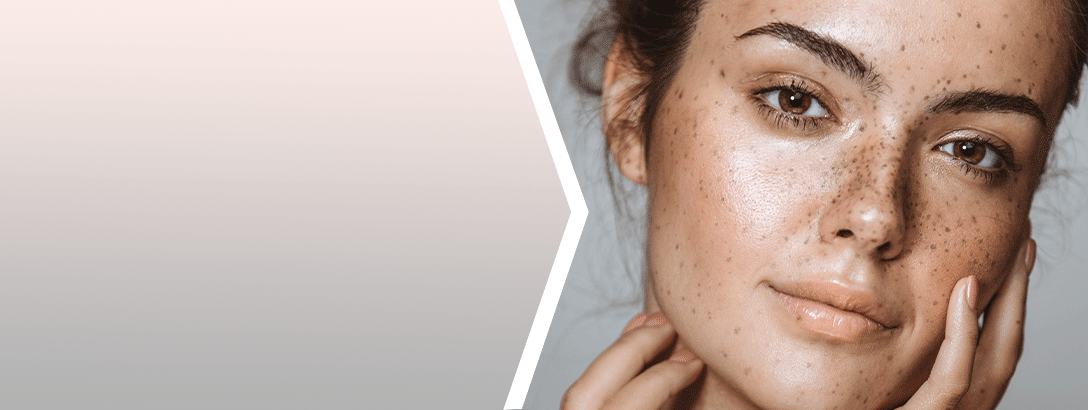 Dr.Jyothi | Best Dermatologist In Vizag
